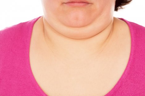 20 Tips How to Lose Neck Fat In a Short Time ?-Charlies Magazines