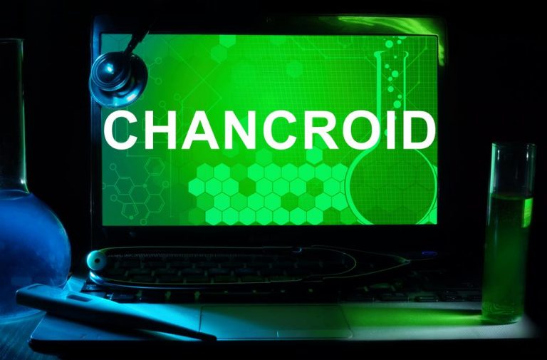 A Complete Guide To Stds [the Sexually Transmitted Diseases] Charlies