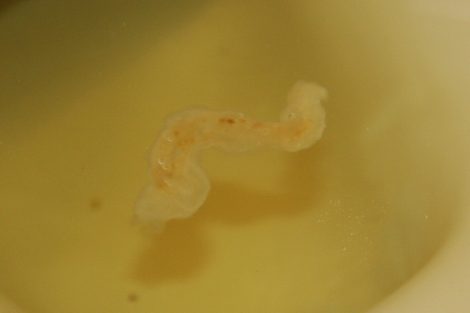 Yellow Stools Causes and Treatment in infants and Adults- Charlies